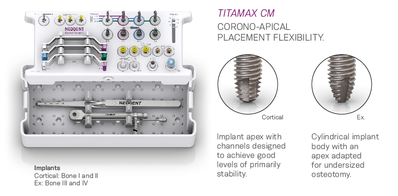 Guided Surgery - Neodent
